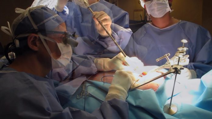 Midcab Surgery - What You Need to Know - HealthBeauty123 | Your Health ...